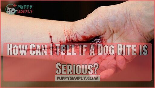 Dog Attack Drew Blood: What to Do Right Now (Step-by-Step Guide)